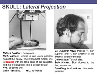 Skull, pns views.pot