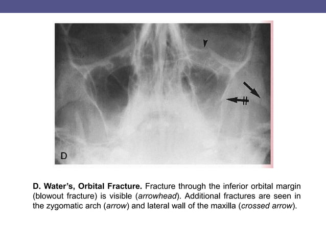 Skull, pns views.pot