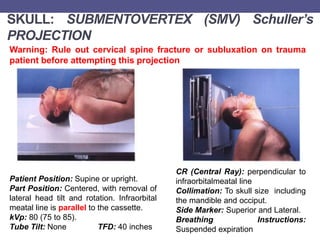 Skull, pns views.pot