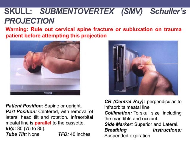 Skull, pns views.pot