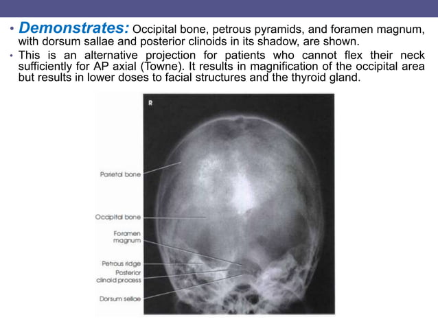 Skull, pns views.pot