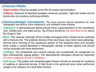 Skull, pns views.pot