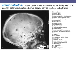 Skull, pns views.pot