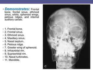 Skull, pns views.pot
