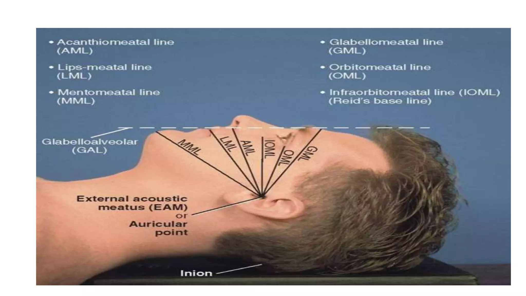 Skull positioning by a.s kannan | PPTX