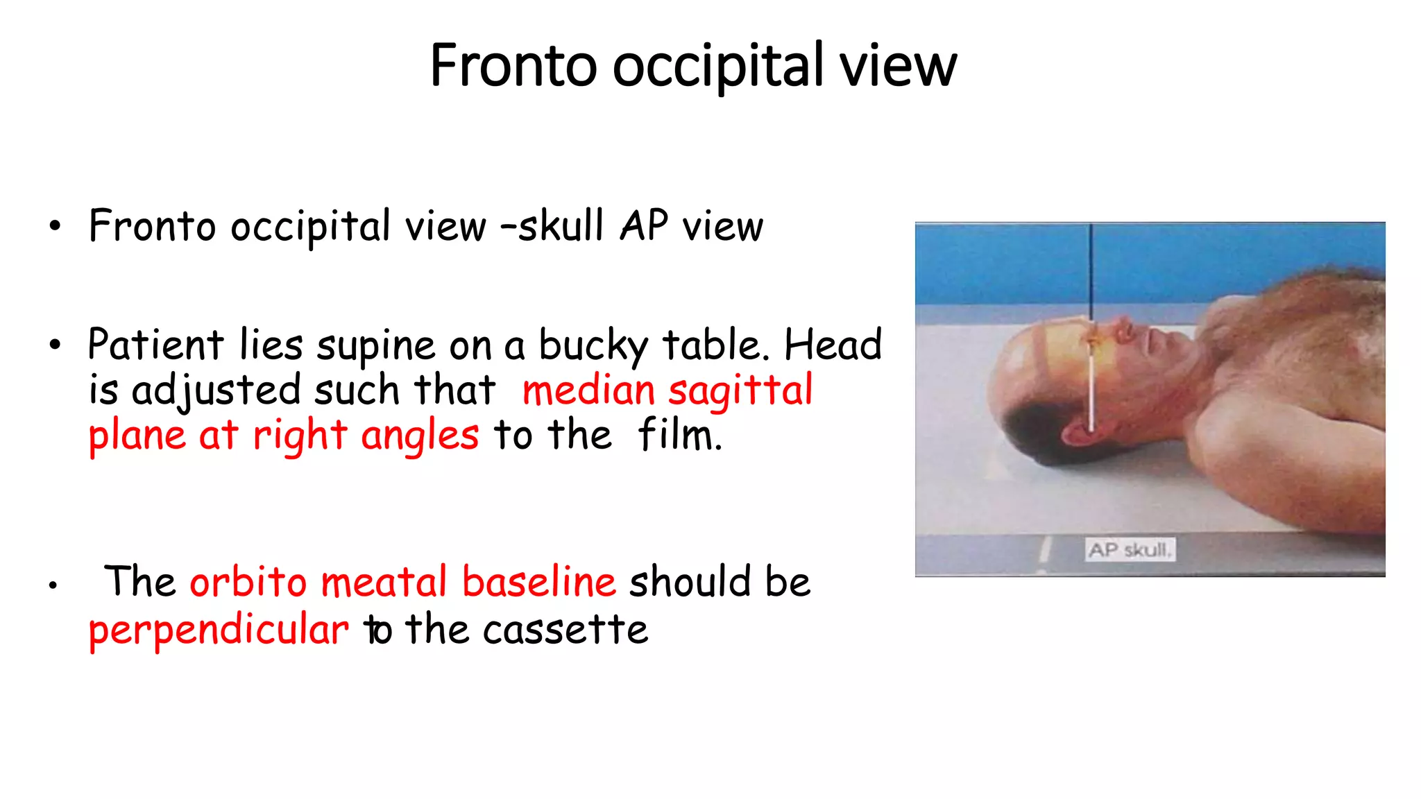 Skull positioning by a.s kannan | PPTX