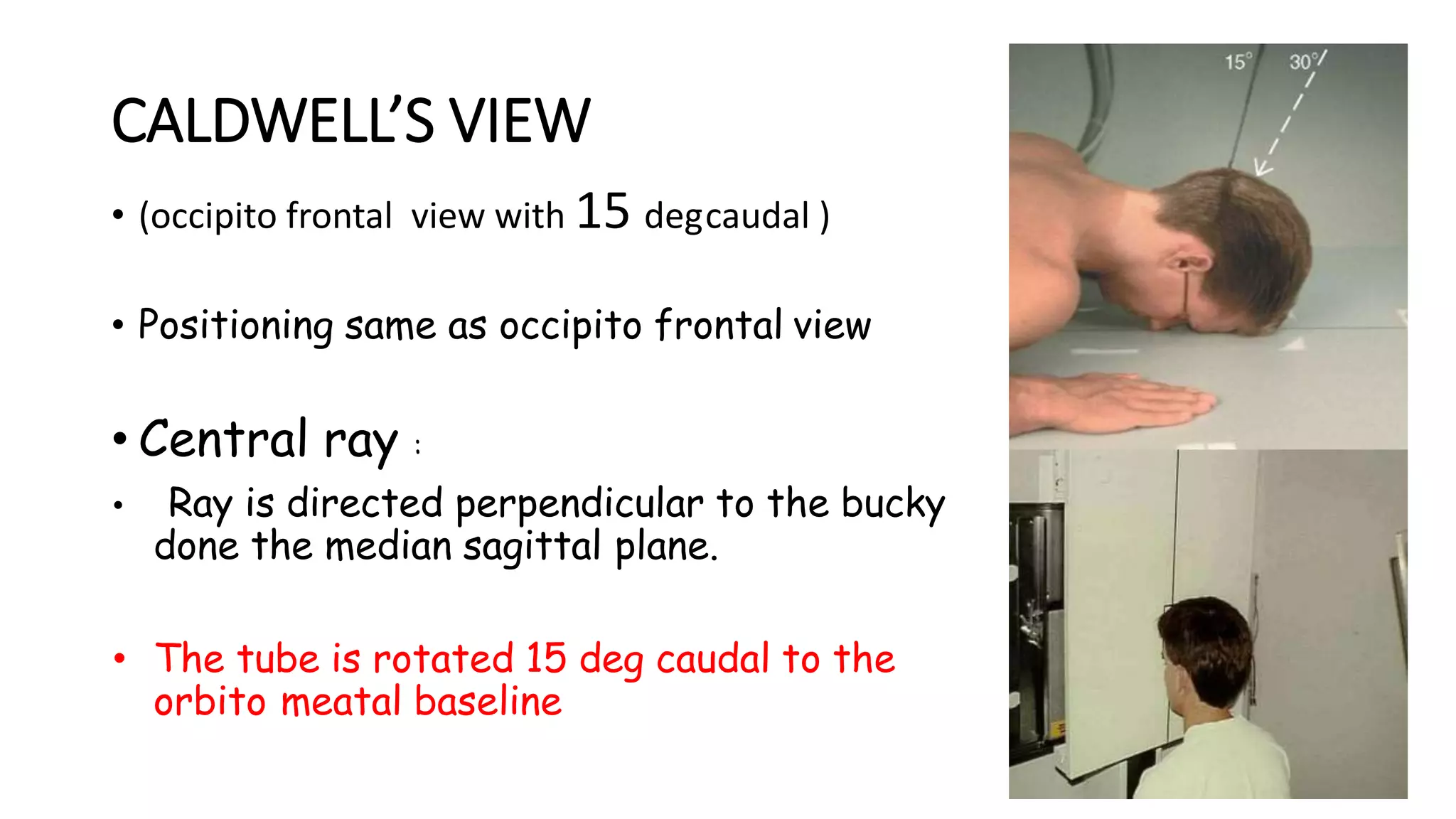Skull positioning by a.s kannan | PPTX