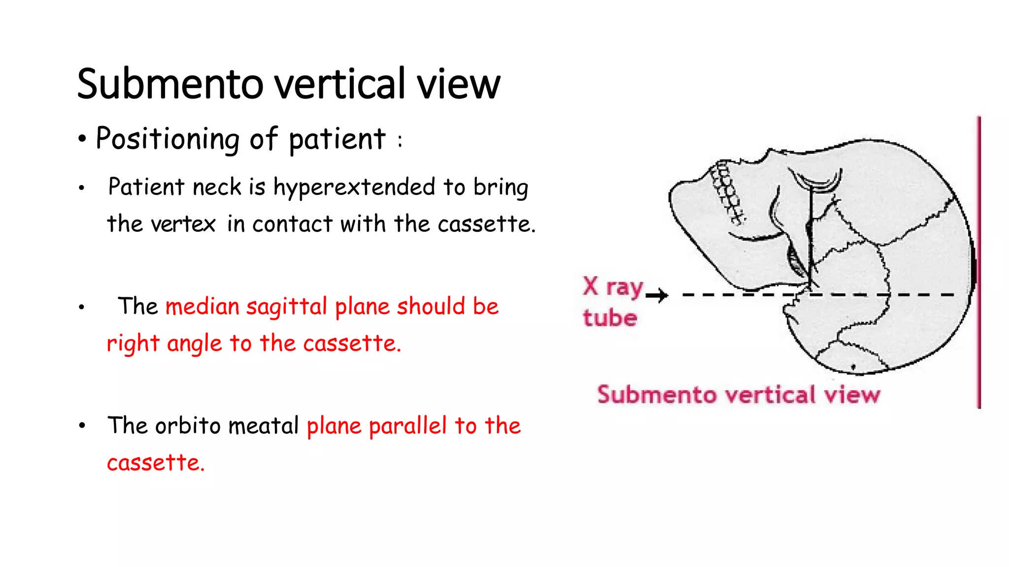 Skull positioning by a.s kannan | PPTX