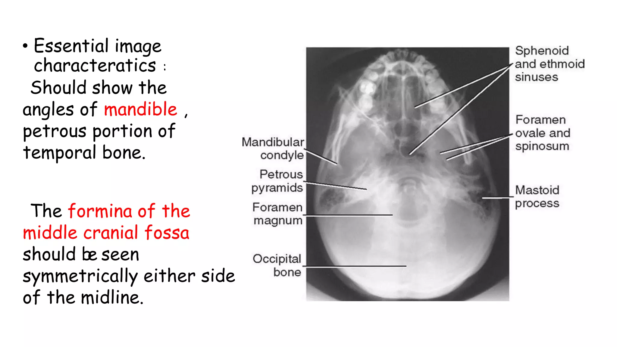 Skull positioning by a.s kannan | PPTX
