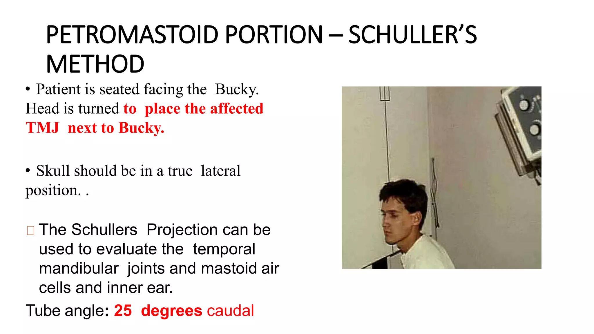 Skull positioning by a.s kannan | PPTX