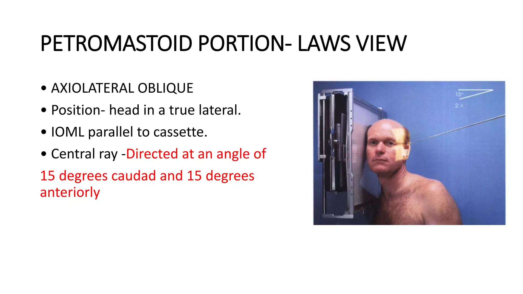 Skull positioning by a.s kannan | PPTX