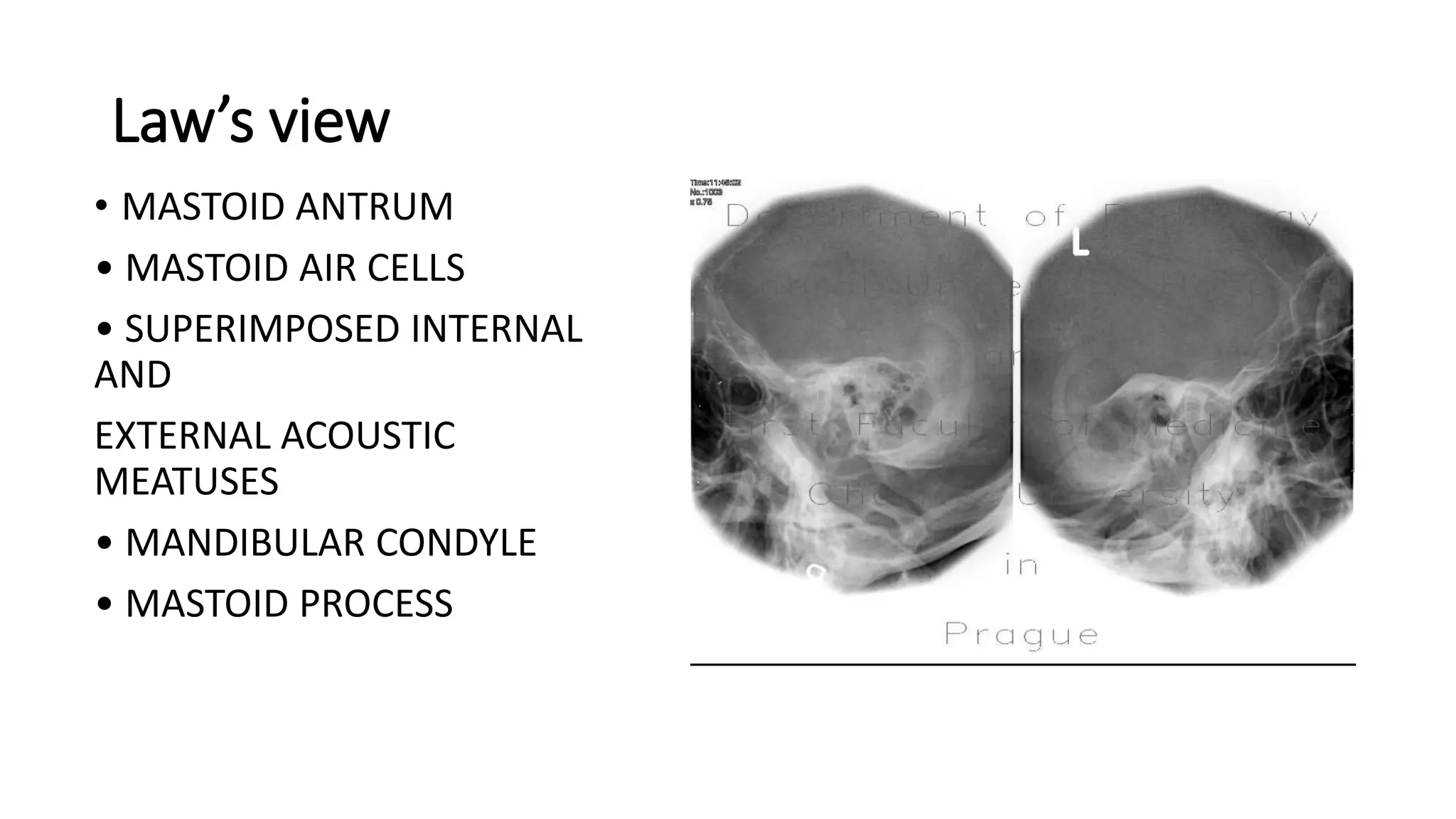 Skull positioning by a.s kannan | PPTX