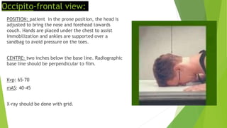 skull presentation by neha singh.pptx