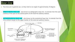 skull presentation by neha singh.pptx