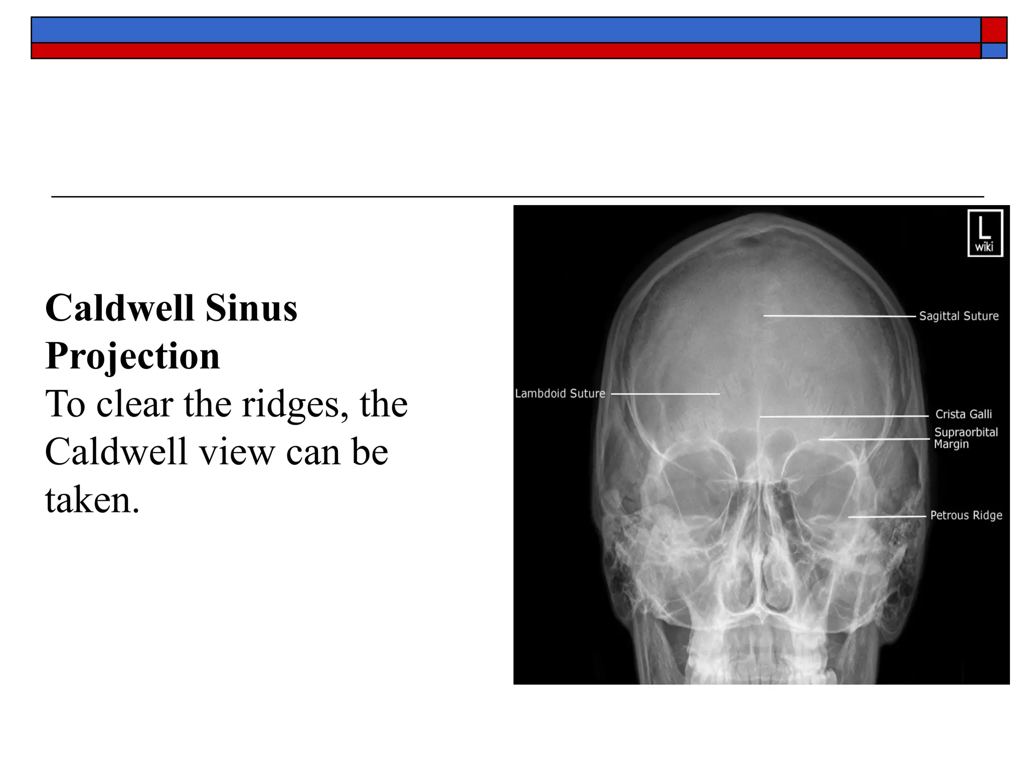 Basic anatomy Views -importance and positioning Interpretation Skull ...