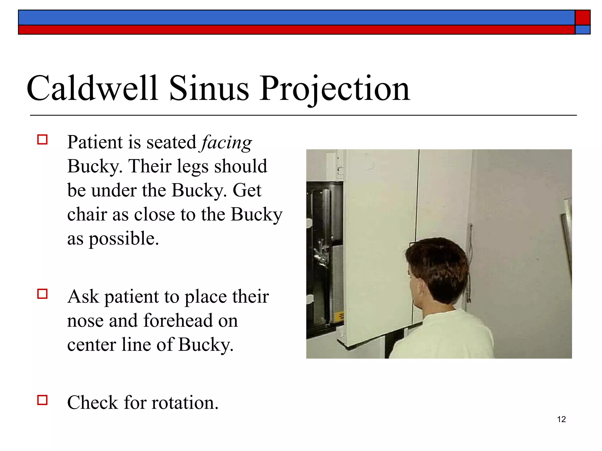Basic anatomy Views -importance and positioning Interpretation Skull ...