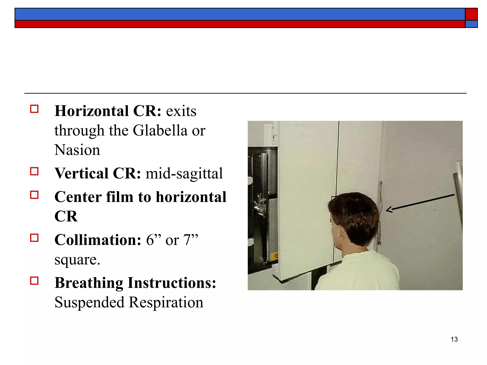 Basic anatomy Views -importance and positioning Interpretation Skull ...