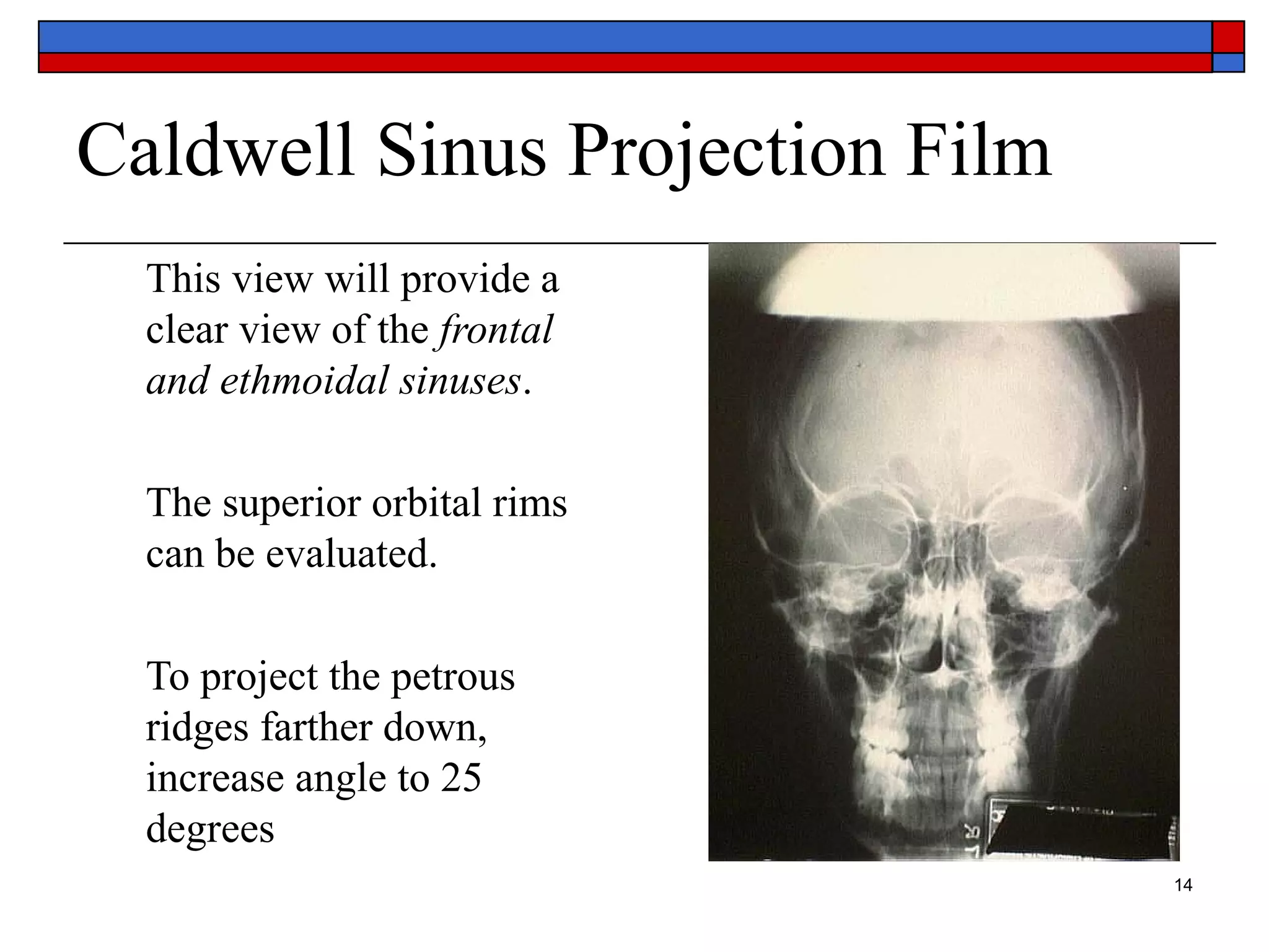Basic anatomy Views -importance and positioning Interpretation Skull ...
