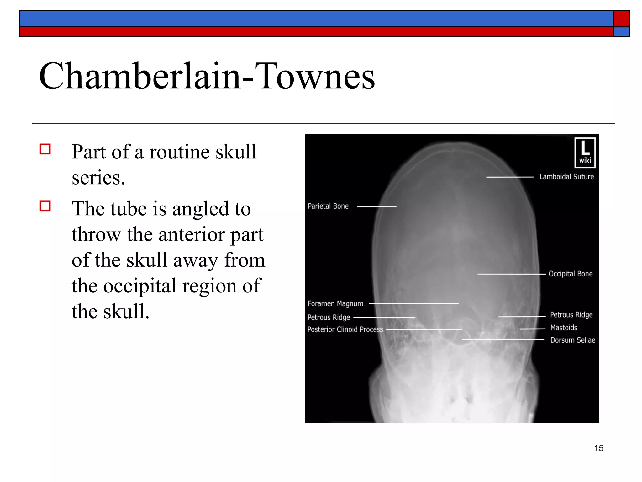 Basic anatomy Views -importance and positioning Interpretation Skull ...