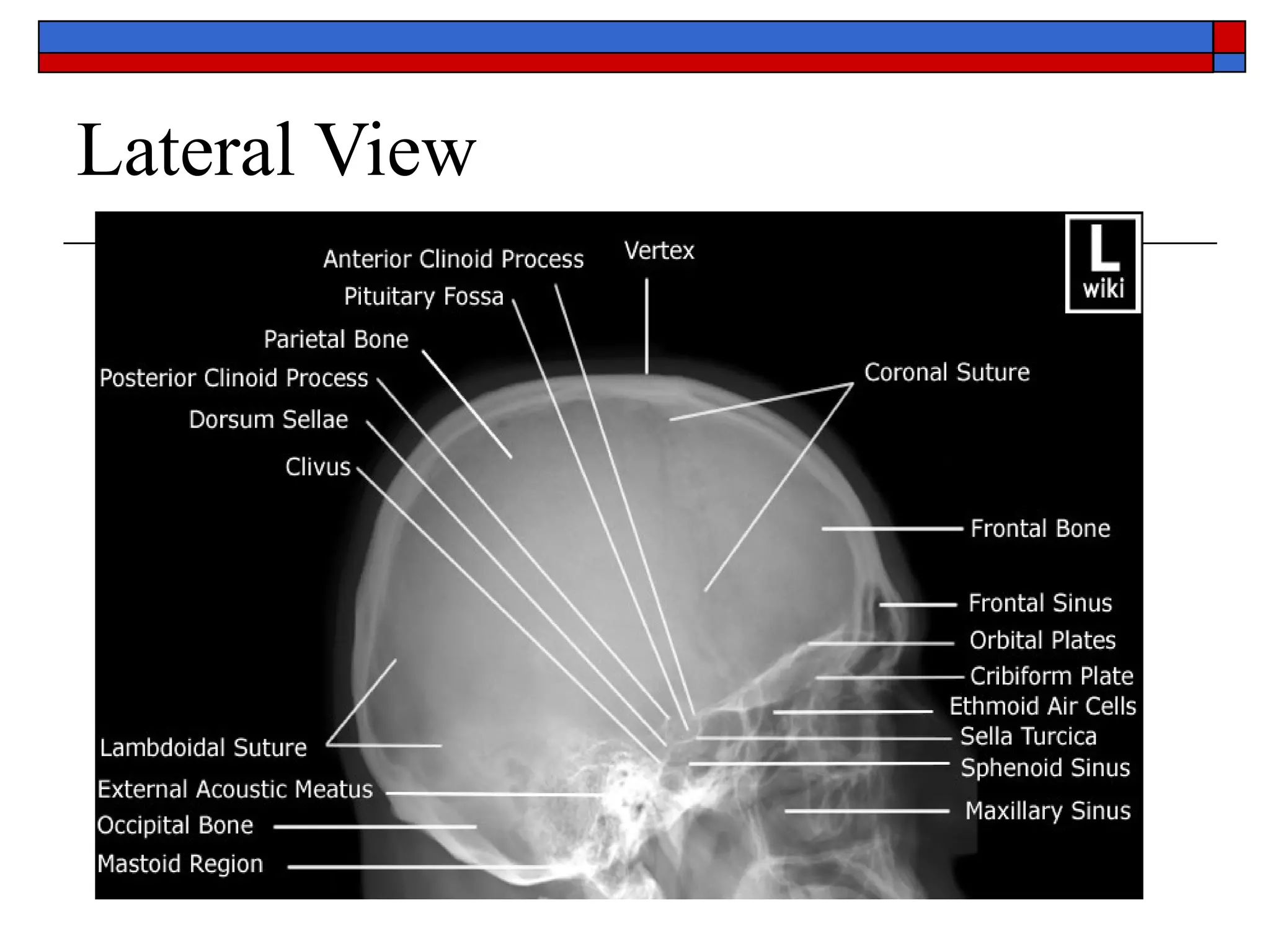 Basic anatomy Views -importance and positioning Interpretation Skull ...