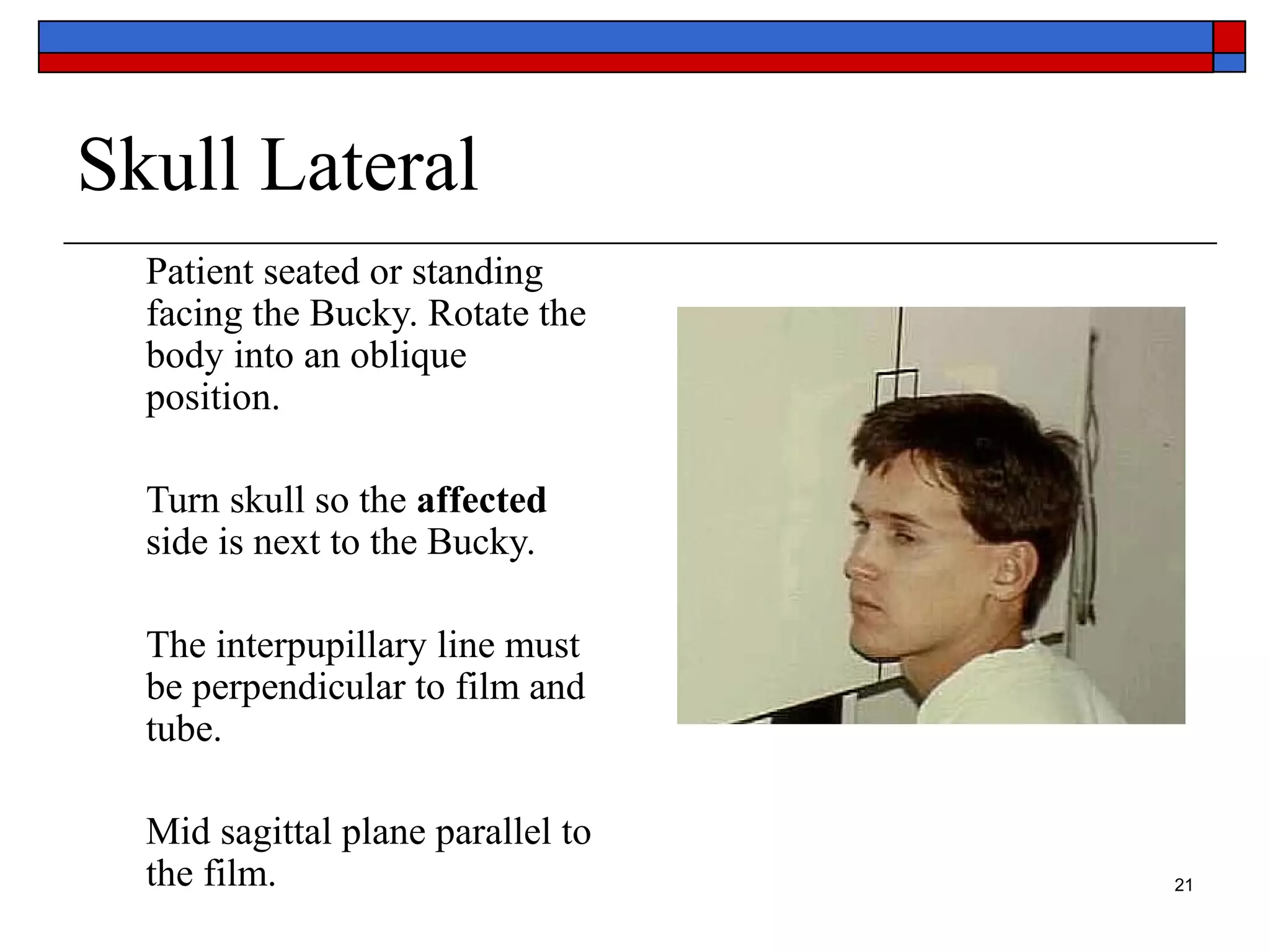 Basic anatomy Views -importance and positioning Interpretation Skull ...