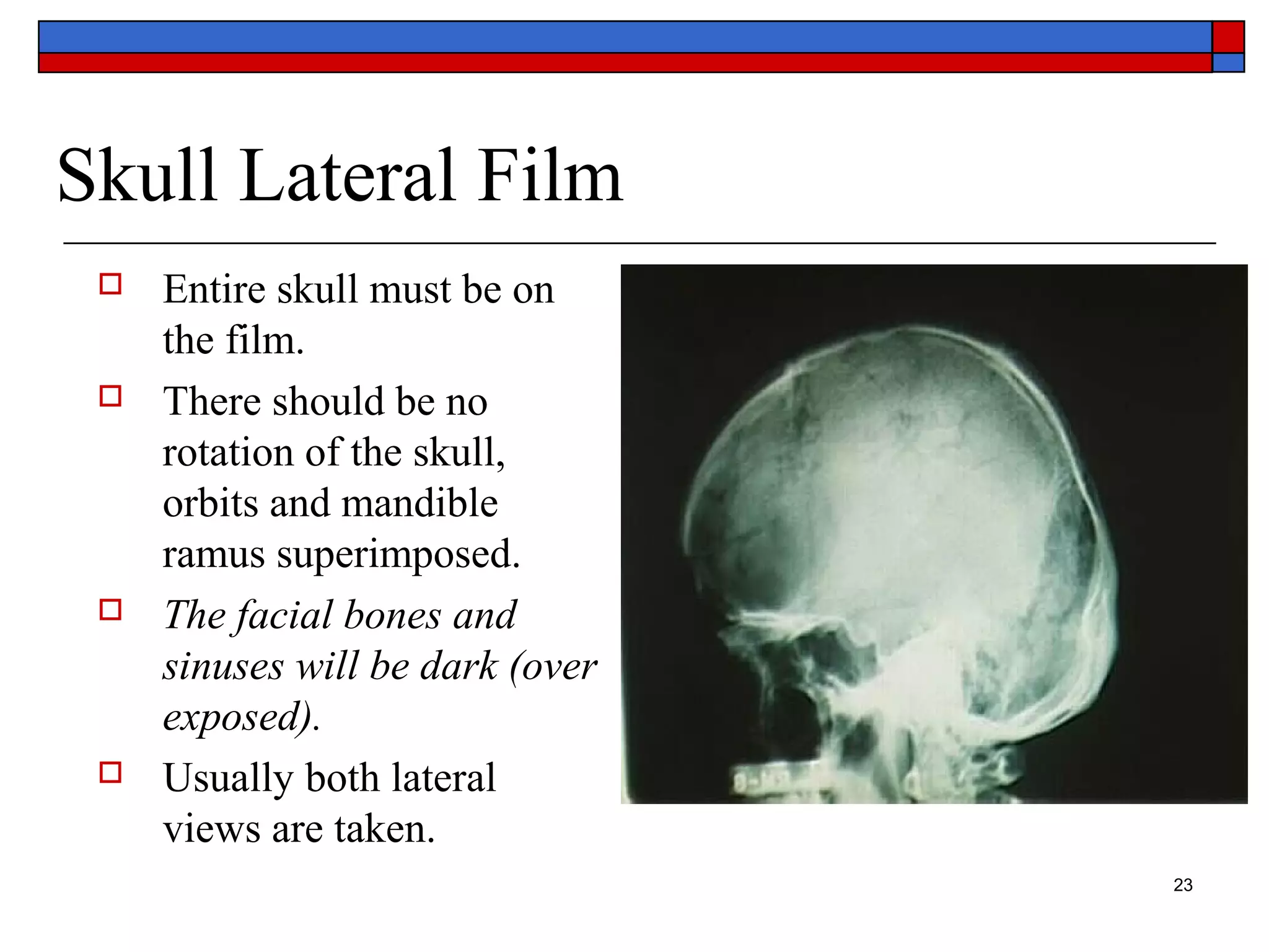 Basic anatomy Views -importance and positioning Interpretation Skull ...