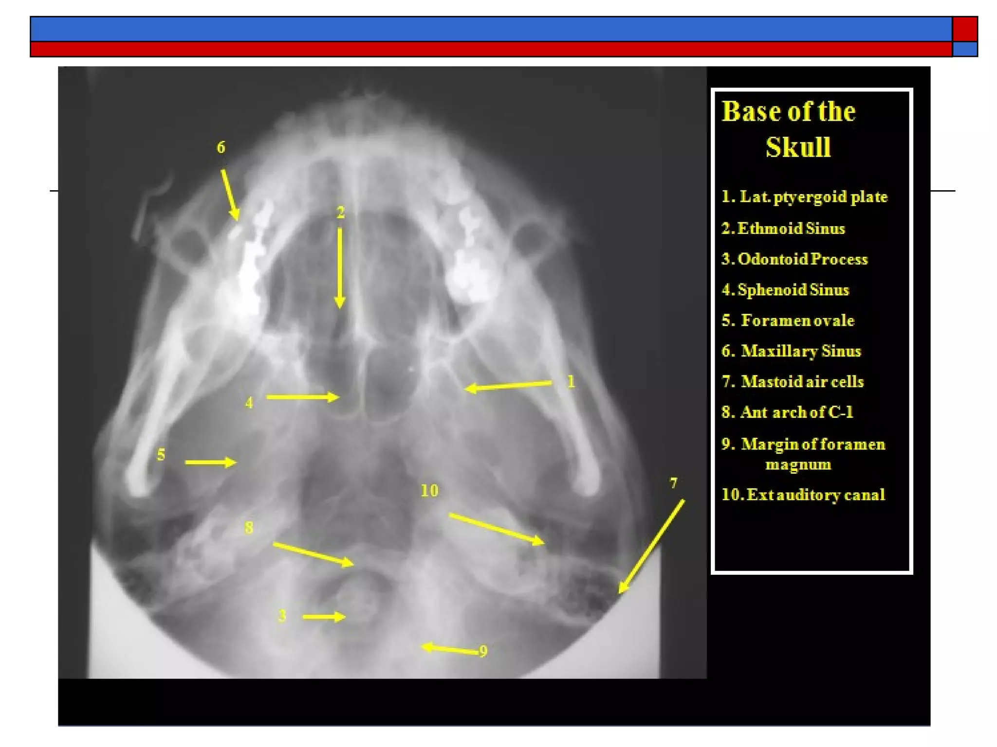Basic anatomy Views -importance and positioning Interpretation Skull ...