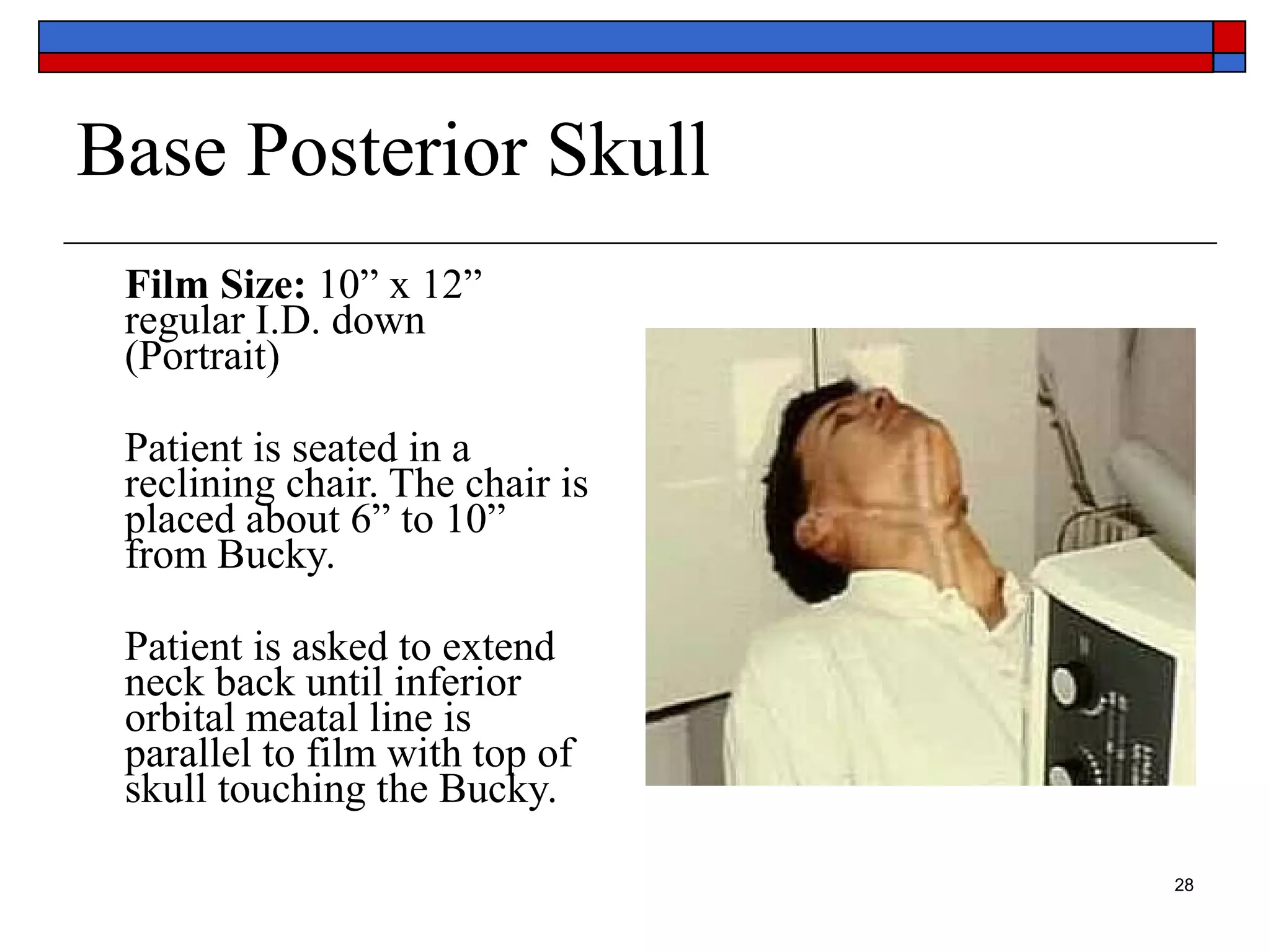 Basic anatomy Views -importance and positioning Interpretation Skull ...
