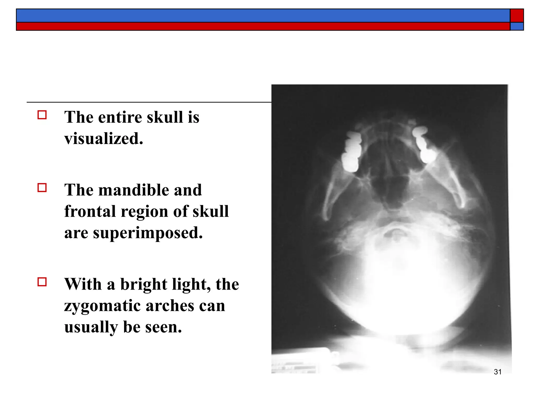 Basic anatomy Views -importance and positioning Interpretation Skull ...