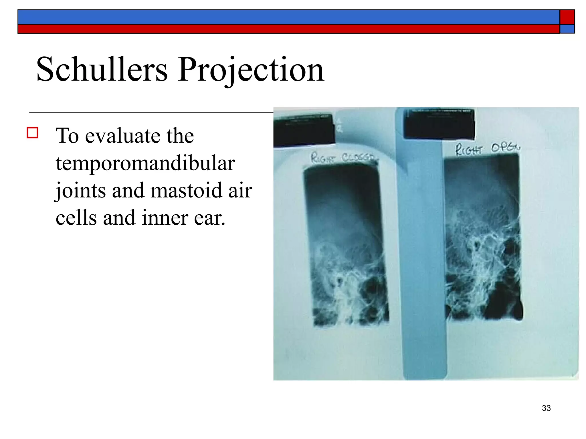 Basic anatomy Views -importance and positioning Interpretation Skull ...