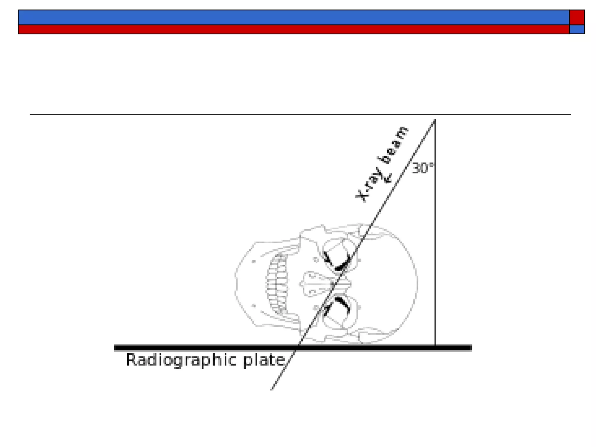 Basic anatomy Views -importance and positioning Interpretation Skull ...