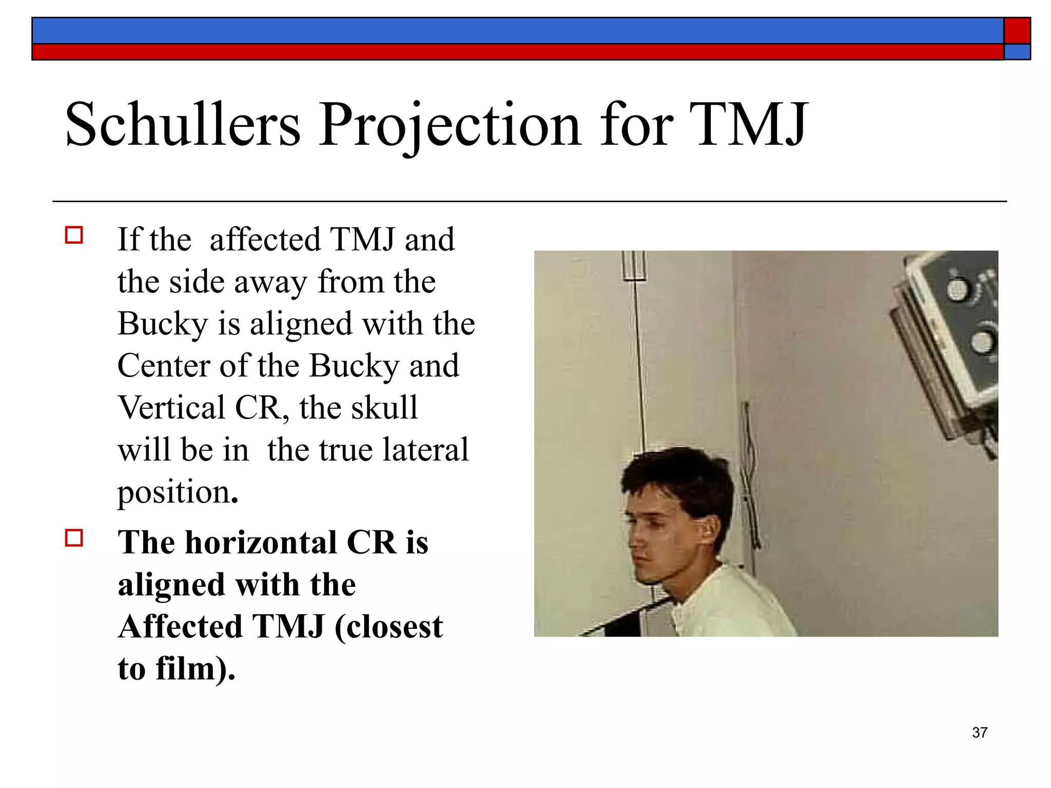 Basic anatomy Views -importance and positioning Interpretation Skull ...