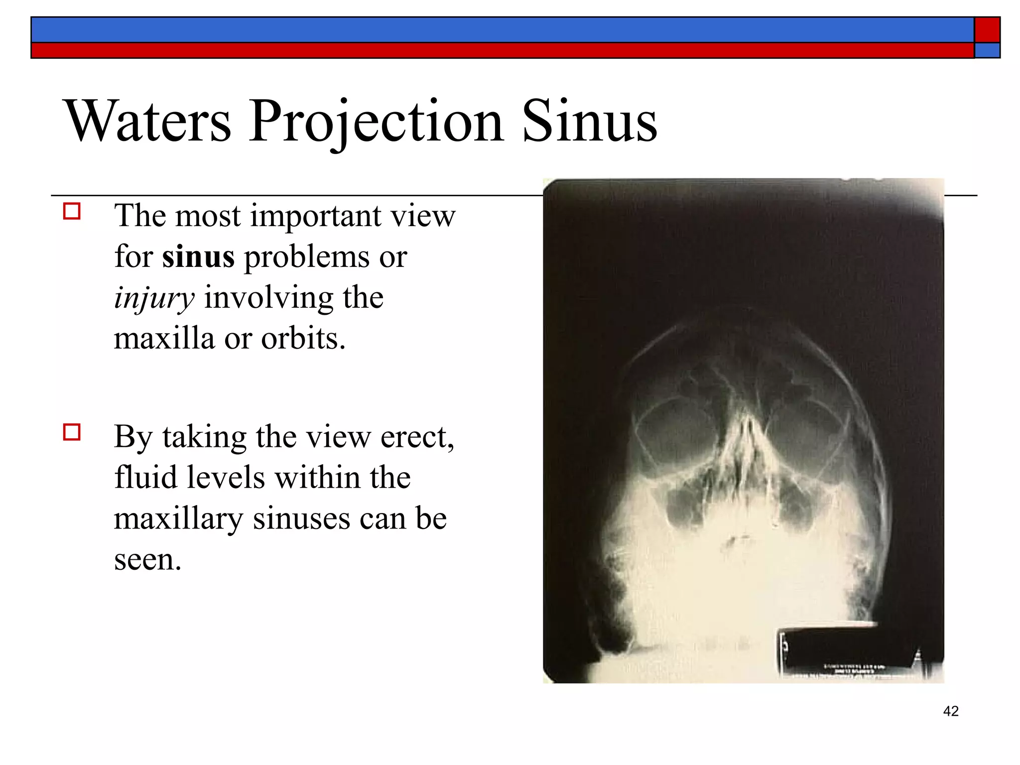 Basic anatomy Views -importance and positioning Interpretation Skull ...