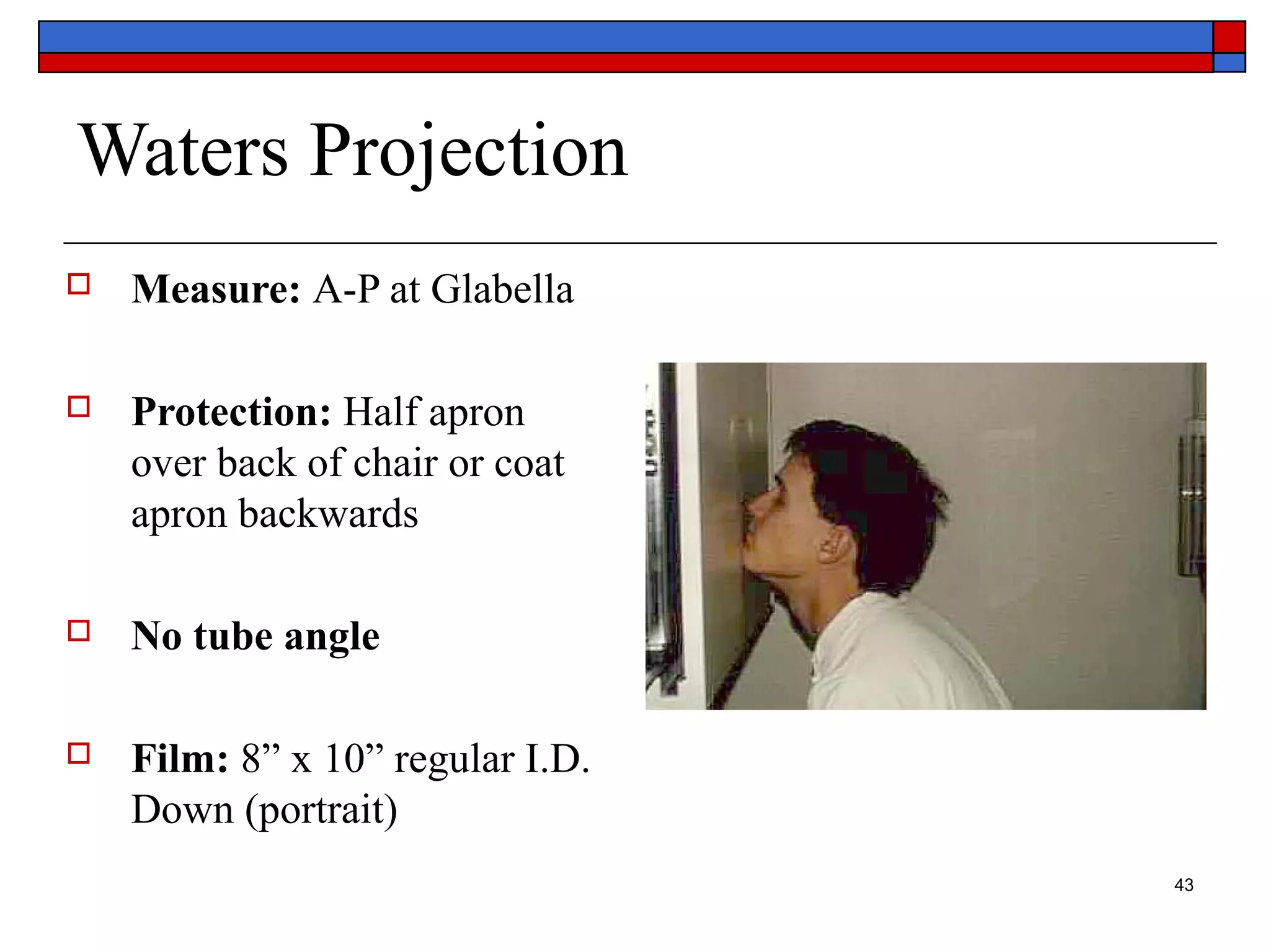 Basic anatomy Views -importance and positioning Interpretation Skull ...
