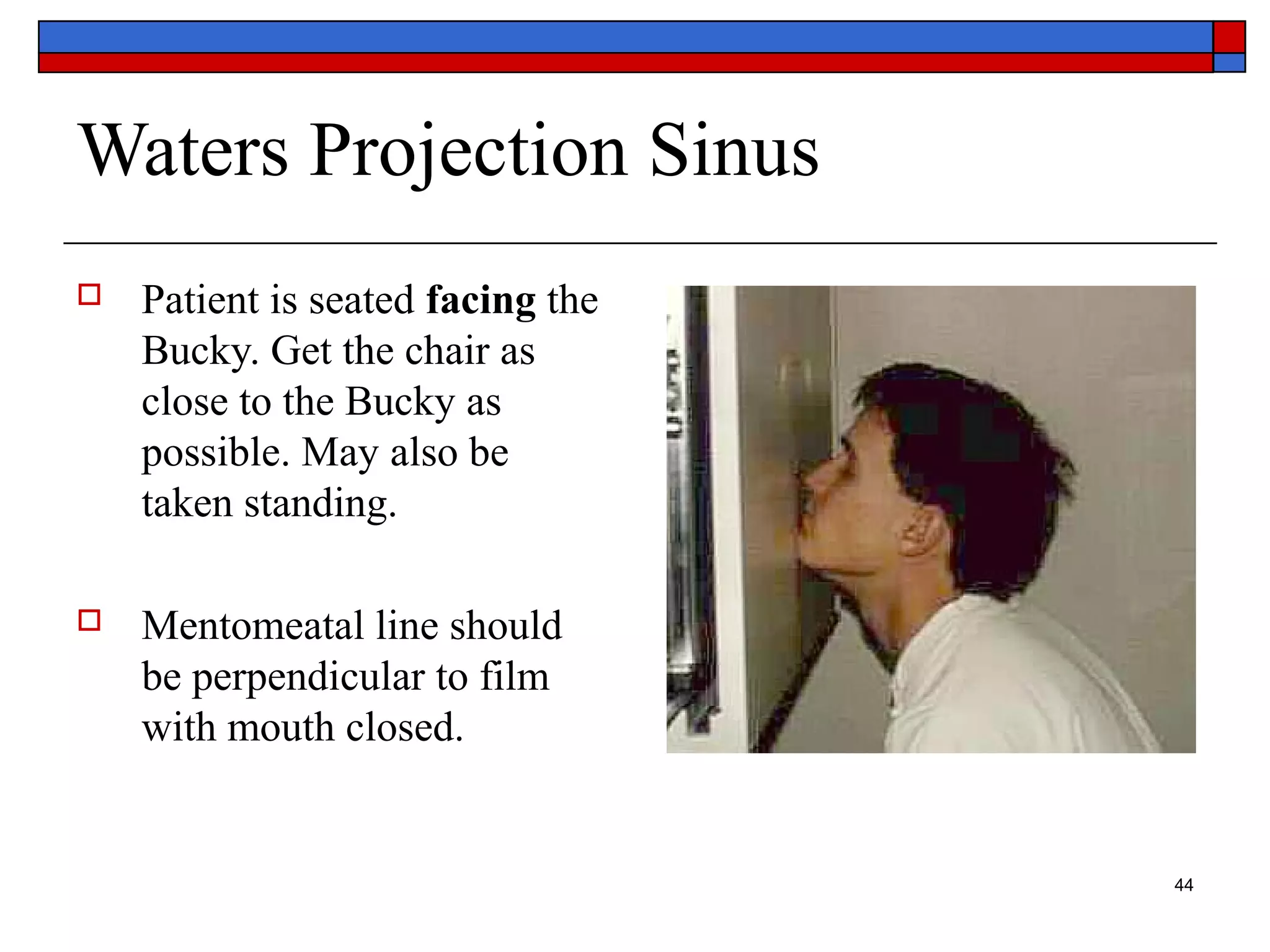 Basic anatomy Views -importance and positioning Interpretation Skull ...
