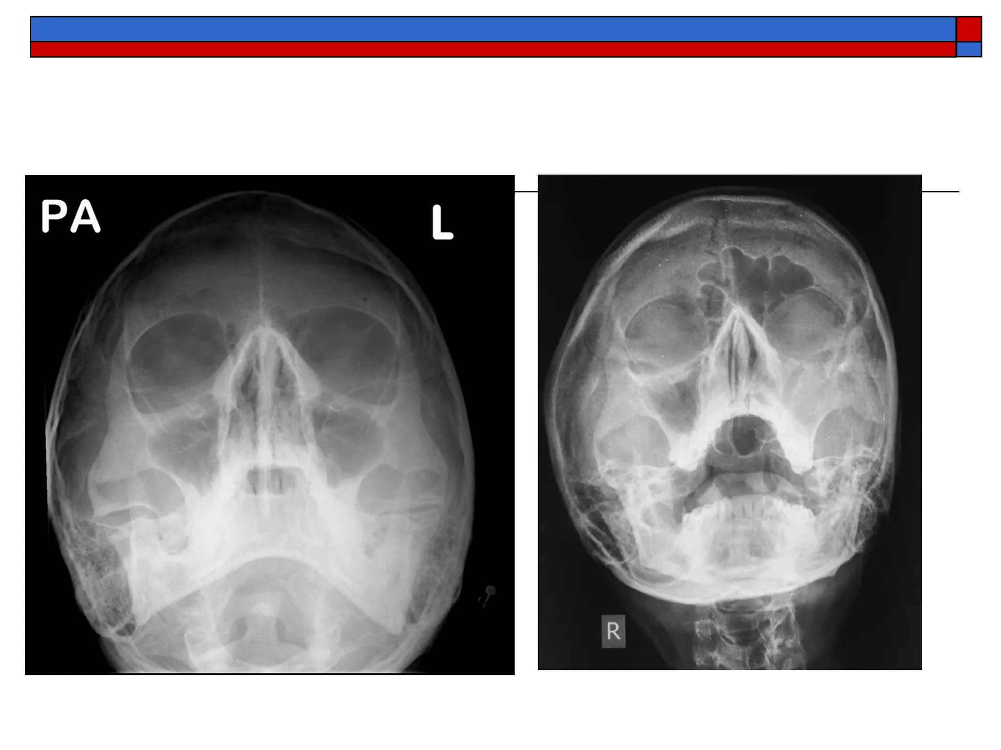 Basic anatomy Views -importance and positioning Interpretation Skull ...