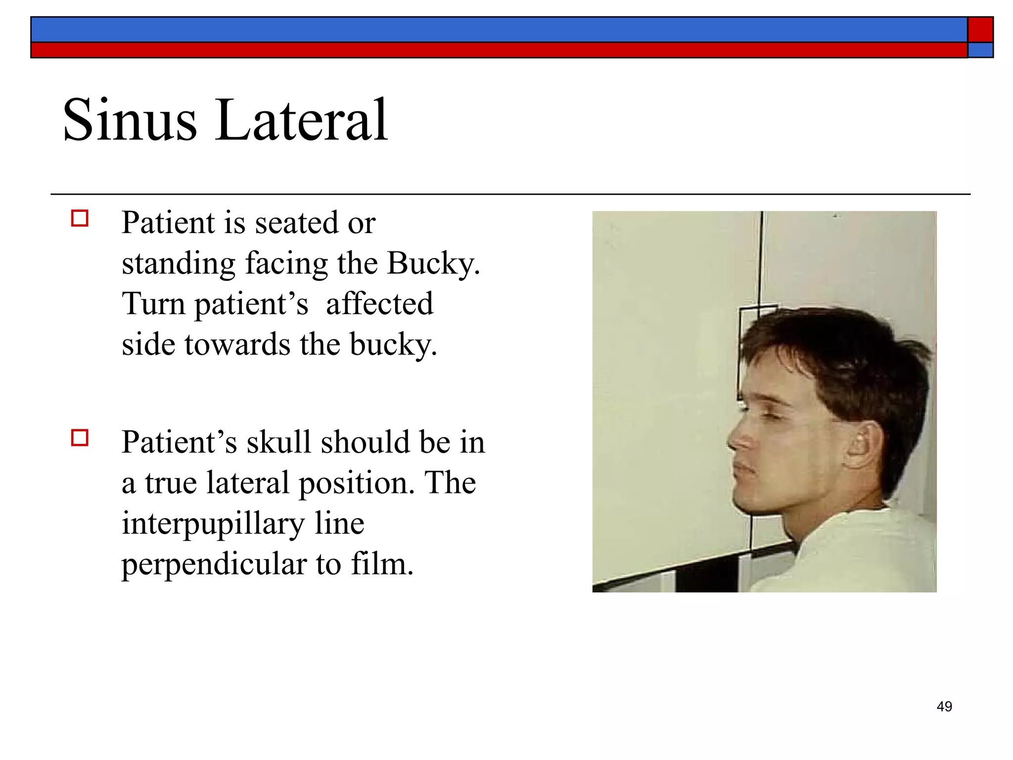 Basic anatomy Views -importance and positioning Interpretation Skull ...