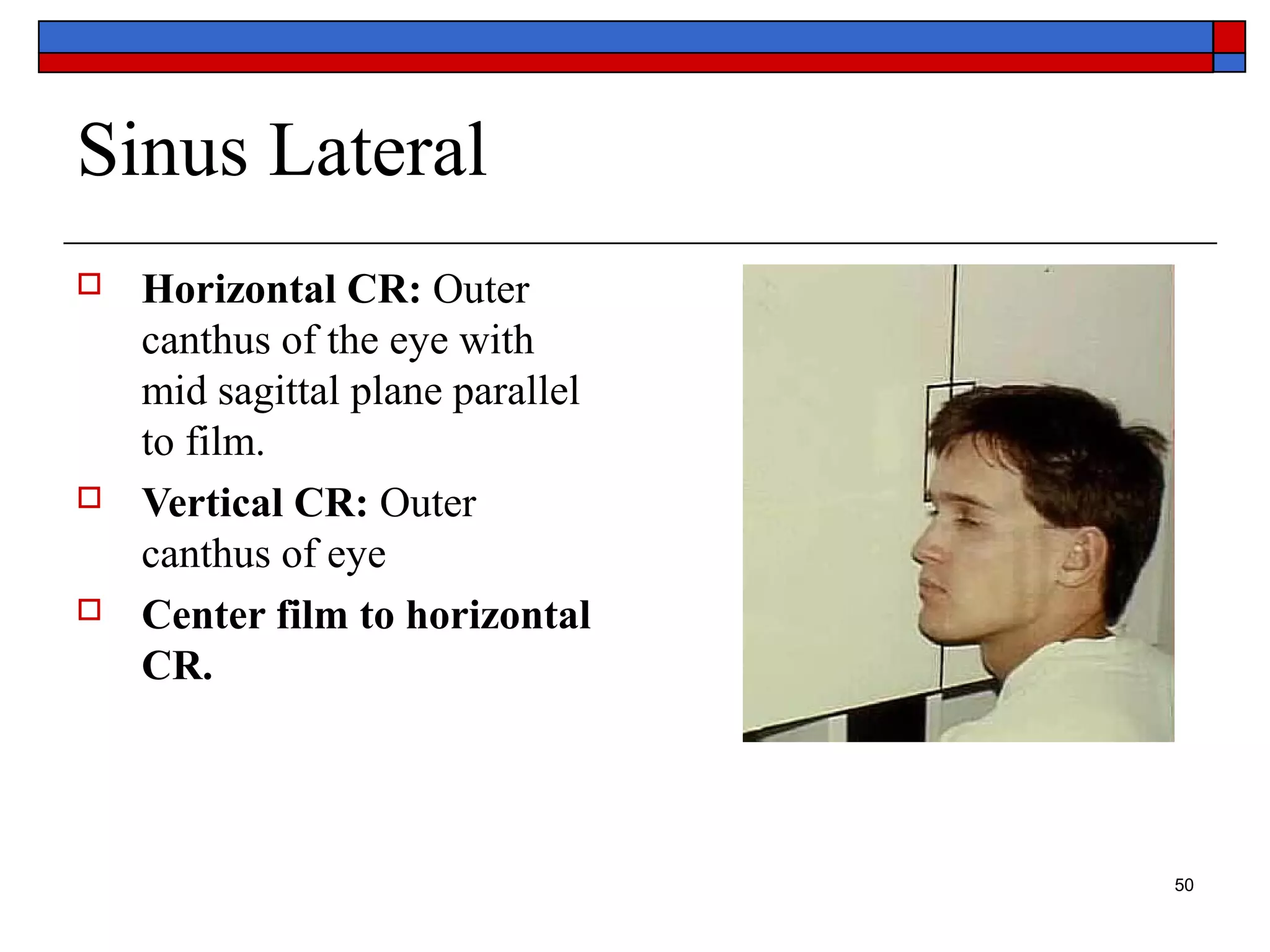 Basic anatomy Views -importance and positioning Interpretation Skull ...