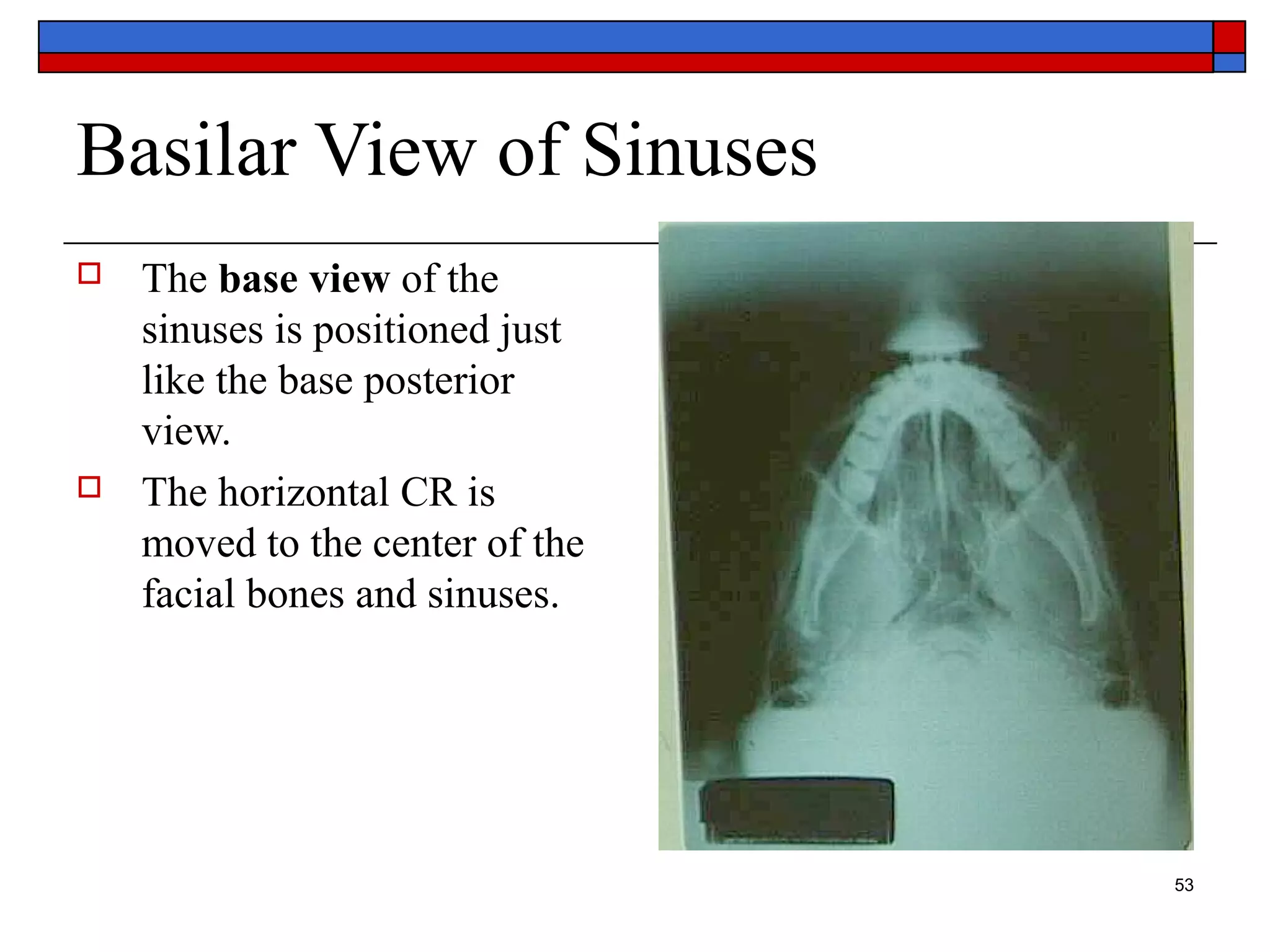 Basic anatomy Views -importance and positioning Interpretation Skull ...