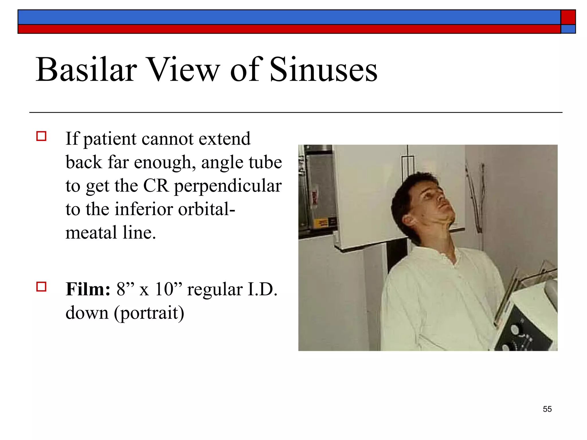 Basic anatomy Views -importance and positioning Interpretation Skull ...