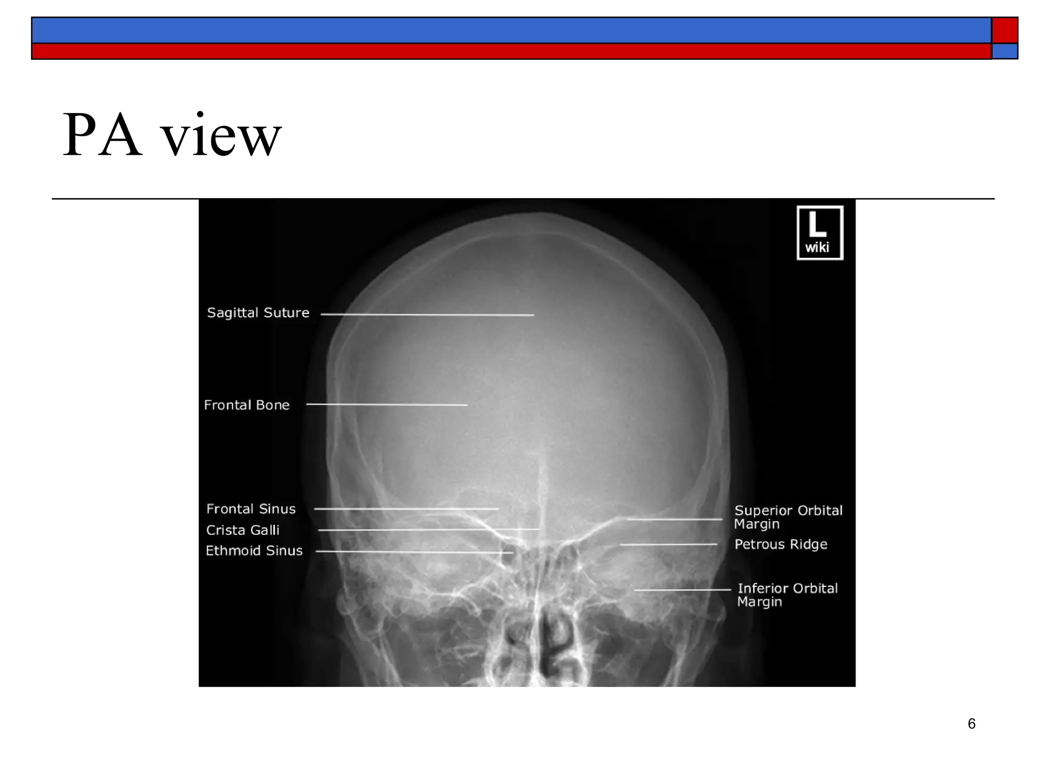 Basic anatomy Views -importance and positioning Interpretation Skull ...