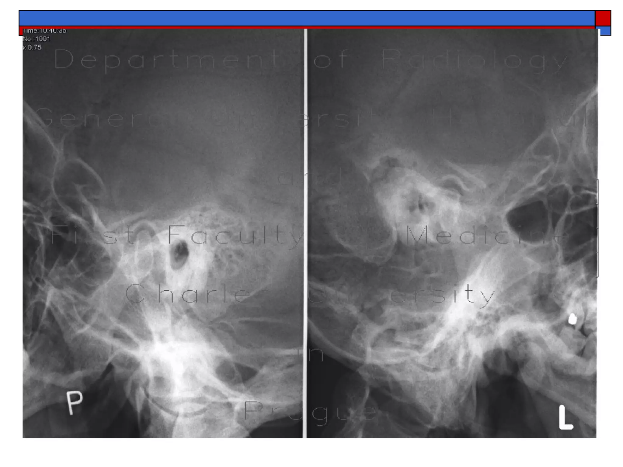 Basic anatomy Views -importance and positioning Interpretation Skull ...