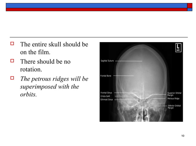 Basic anatomy Views -importance and positioning Interpretation Skull ...
