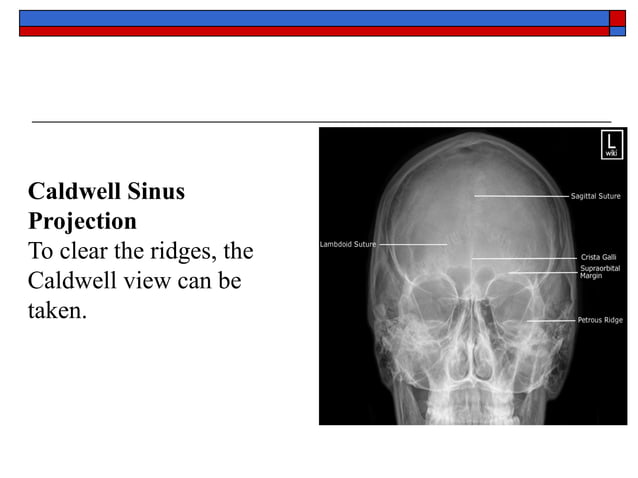 Basic anatomy Views -importance and positioning Interpretation Skull ...