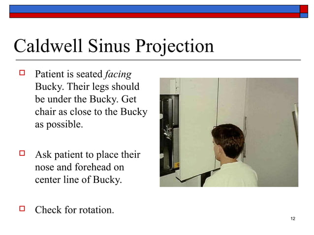 Basic anatomy Views -importance and positioning Interpretation Skull ...