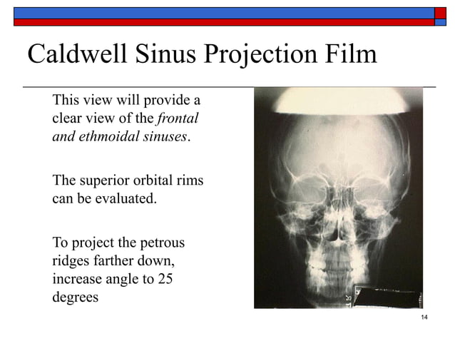 Basic anatomy Views -importance and positioning Interpretation Skull ...