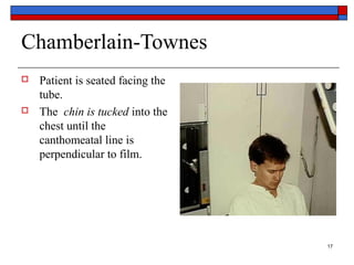 Basic anatomy Views -importance and positioning Interpretation Skull ...