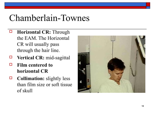 Basic anatomy Views -importance and positioning Interpretation Skull ...