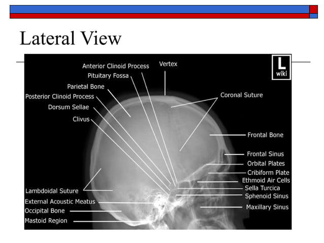 Basic anatomy Views -importance and positioning Interpretation Skull ...