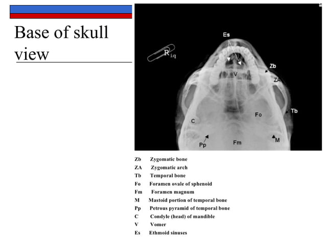 Basic anatomy Views -importance and positioning Interpretation Skull ...